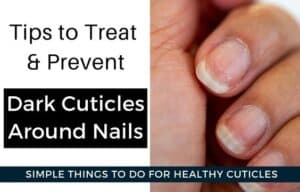 7 Tips to Treat & Prevent Dark Cuticles Around Nails - Easy Nail Tech